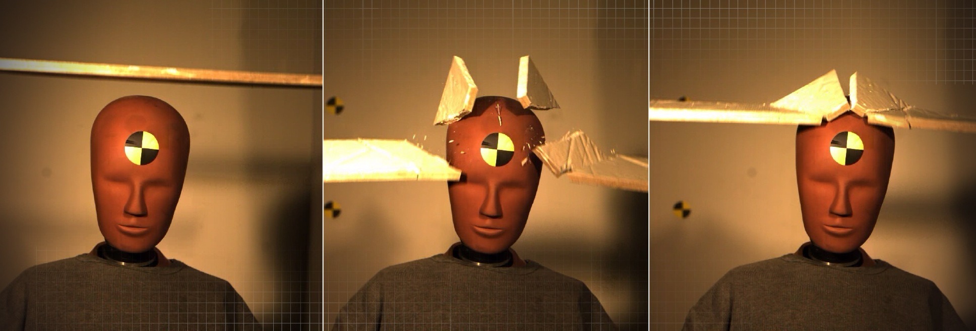 Case Study: Plaster Fall and Head Injury Claim | ARCCA