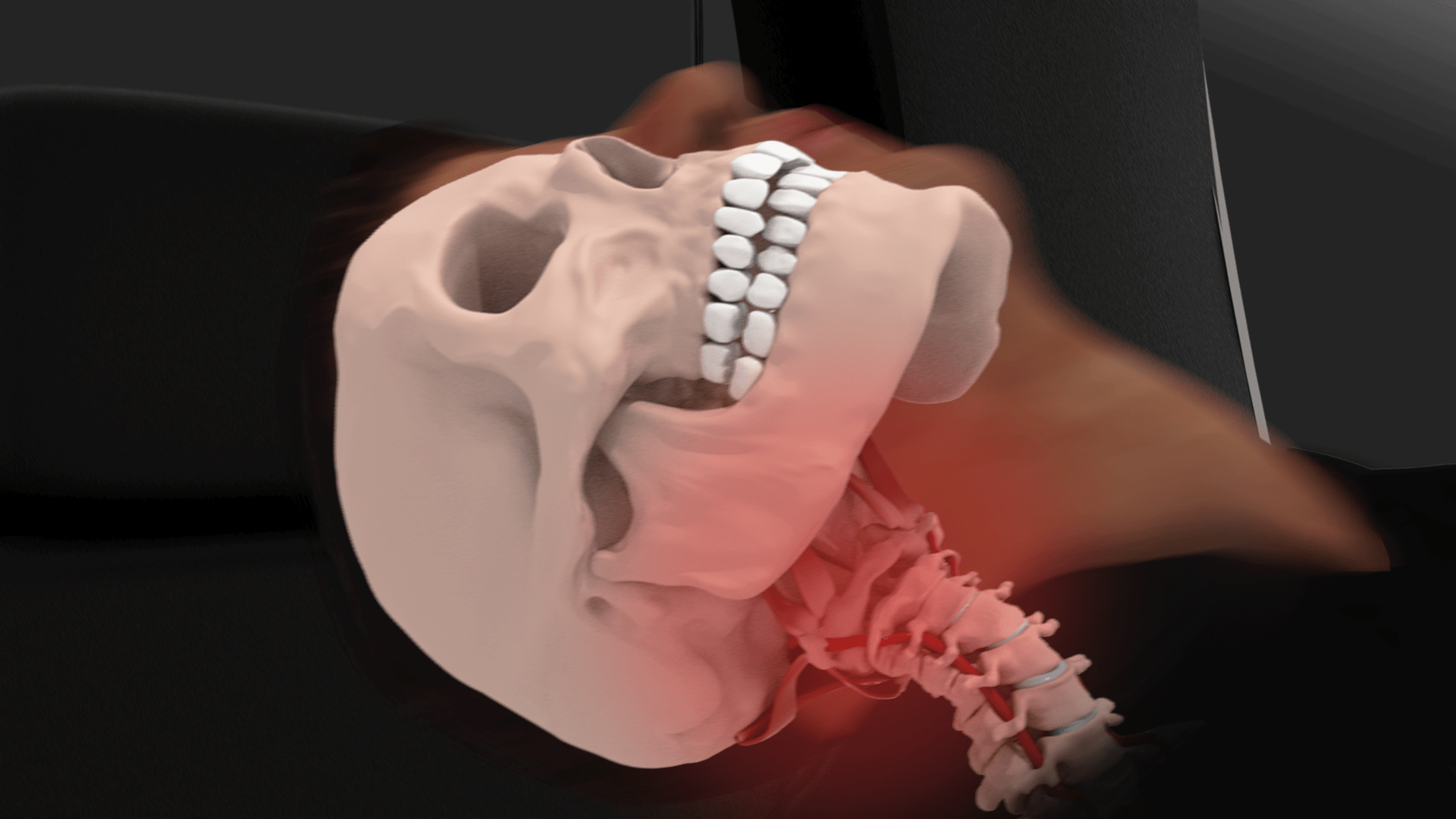 Medical Illustration | ARCCA